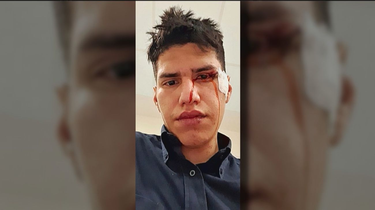 Hablamos con Deyvi, el camarero agredido por los ultras del Atlético ...